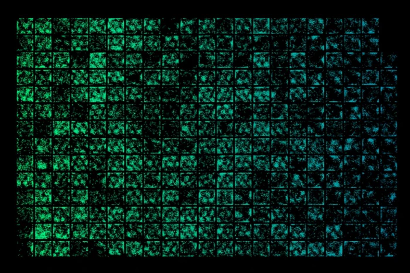 Ce mini-microscope observe les neurones des souris en temps réel
