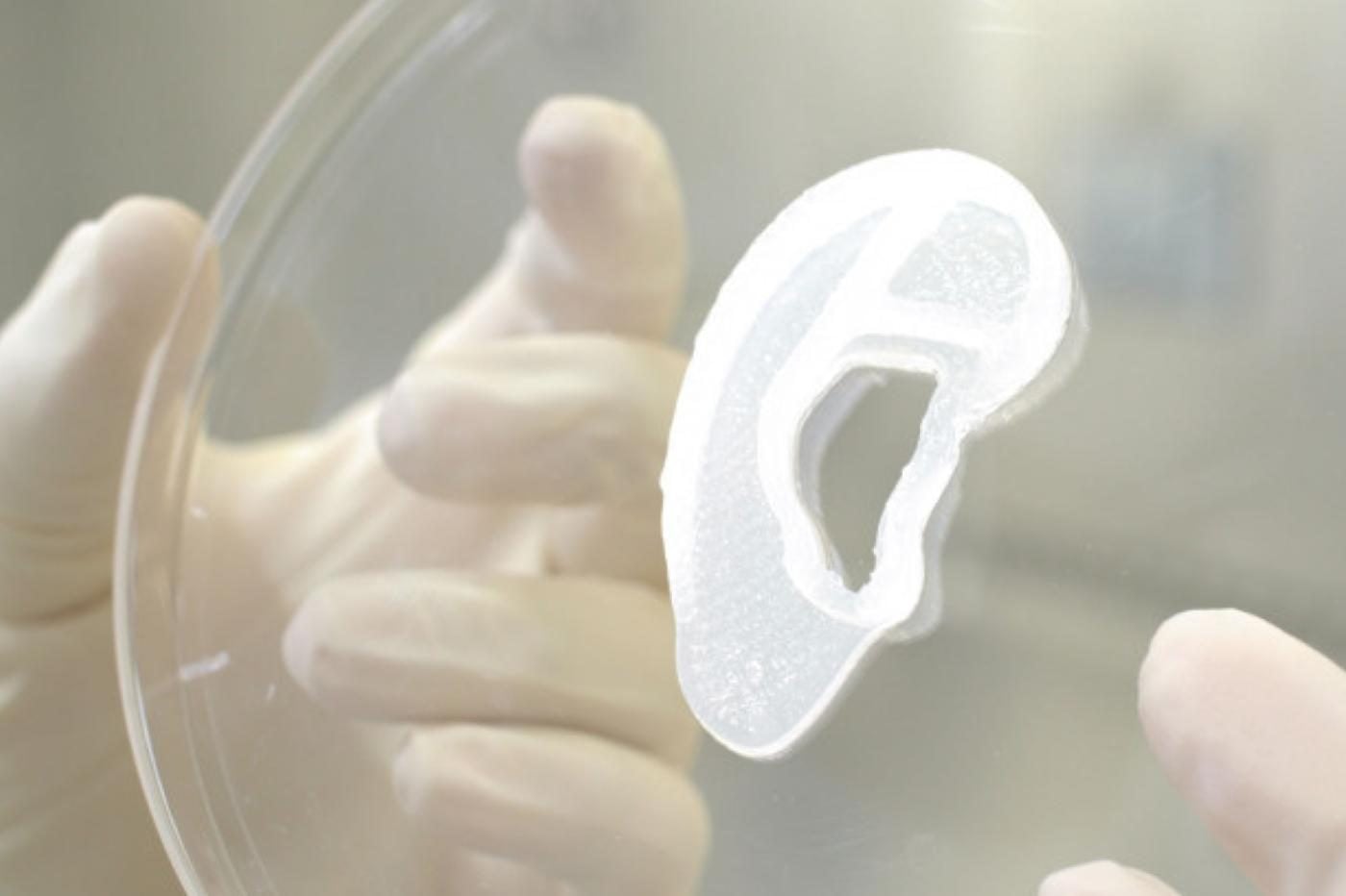 La toute première oreille imprimée en 3D a été greffée sur un humain